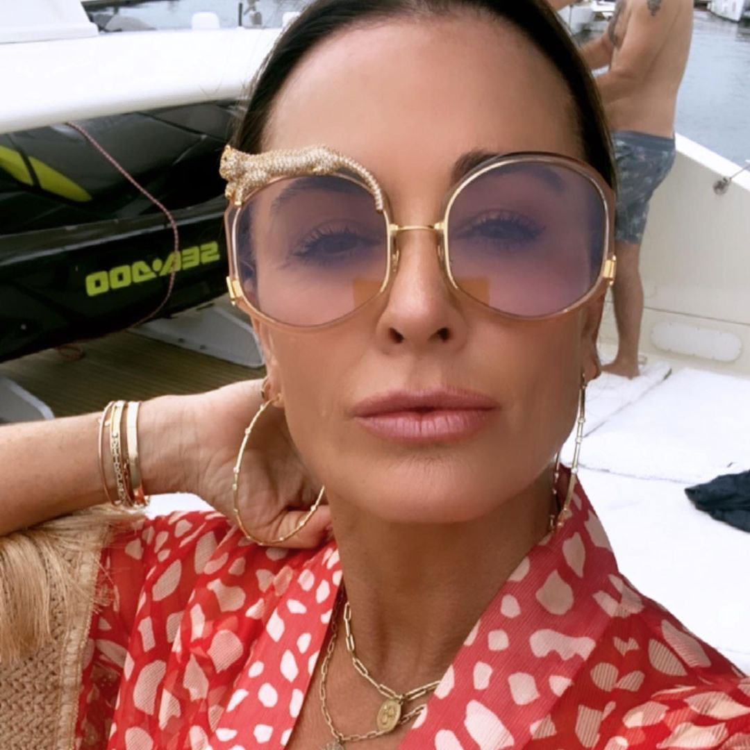 Kyle Richards, then and now: The ‘RHOBH’ star’s changing face in photos